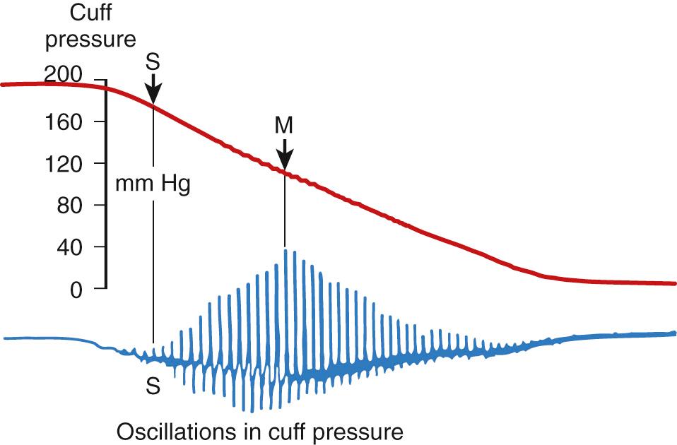 Biomedical Engineering Aspects of Neonatal Cardiorespiratory Monitoring ...