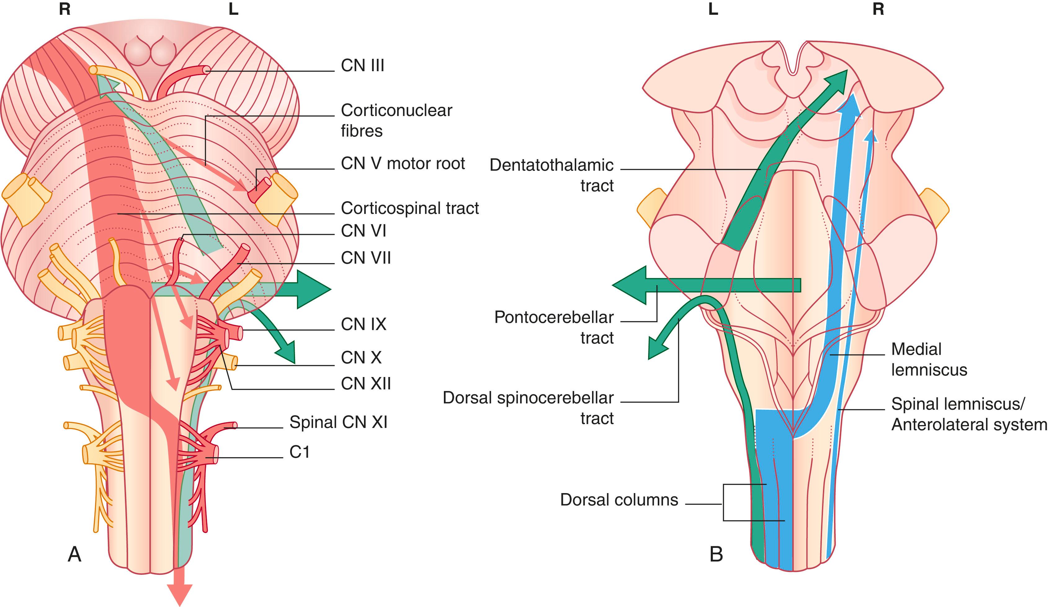 Brainstem - Clinical Tree