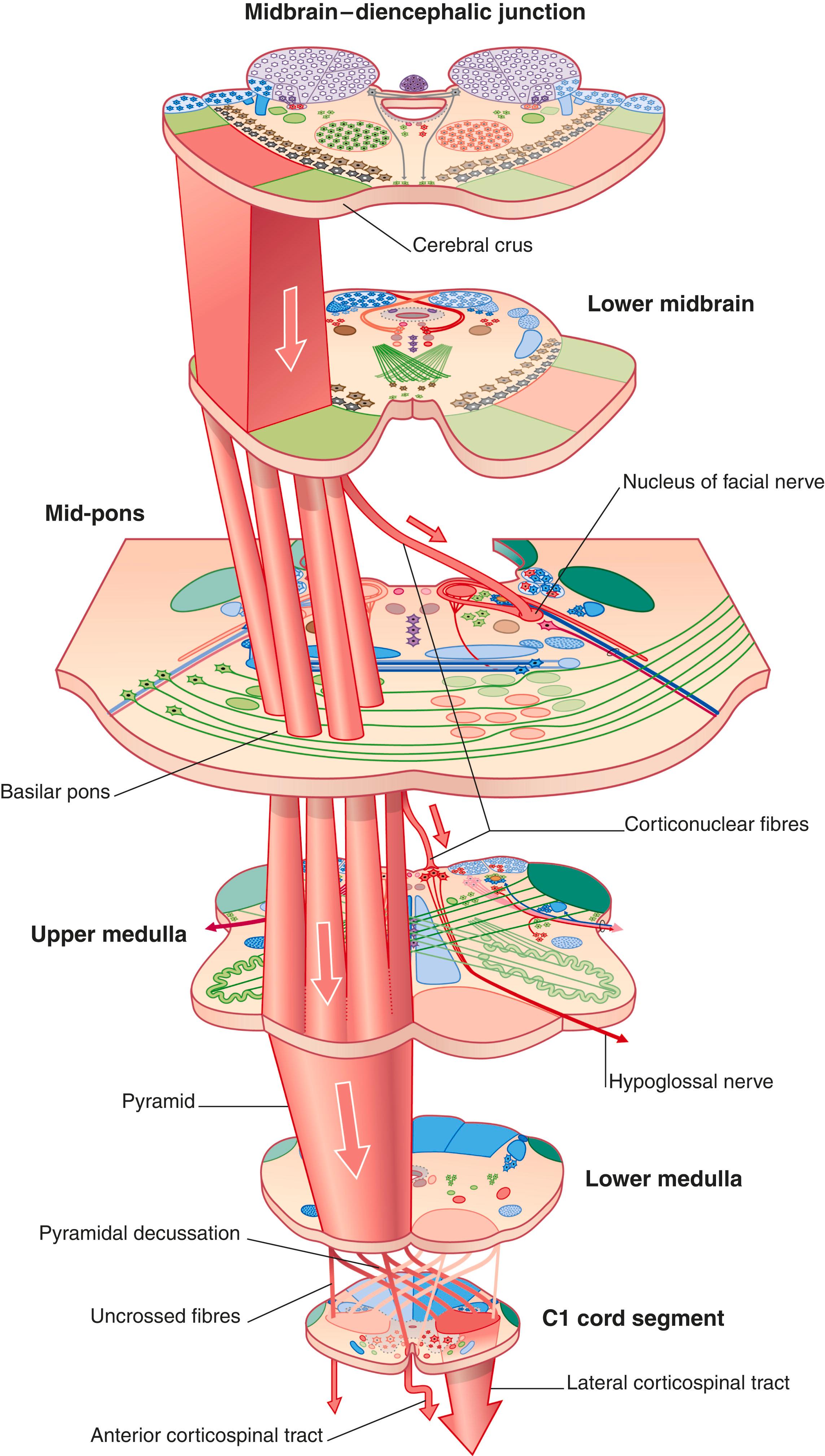 Brainstem - Clinical Tree