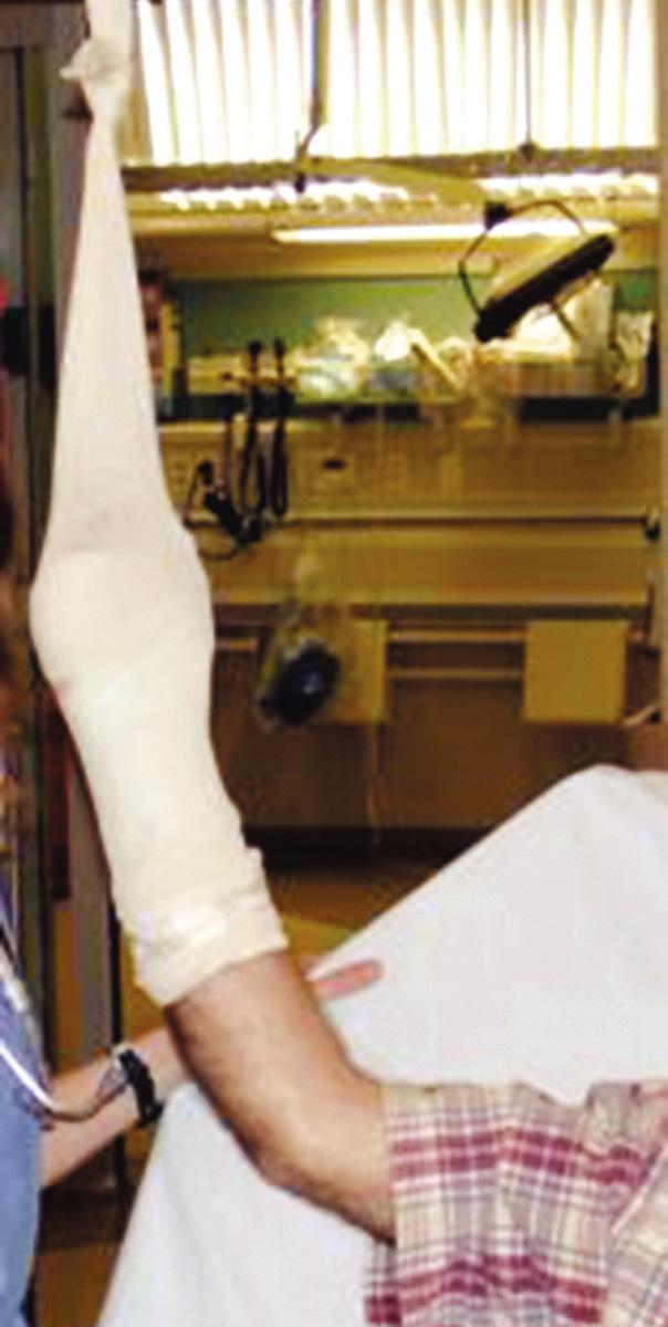 Burn Care Procedures - Clinical Tree