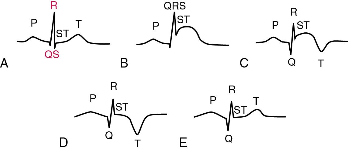 Cardiac function - Clinical Tree