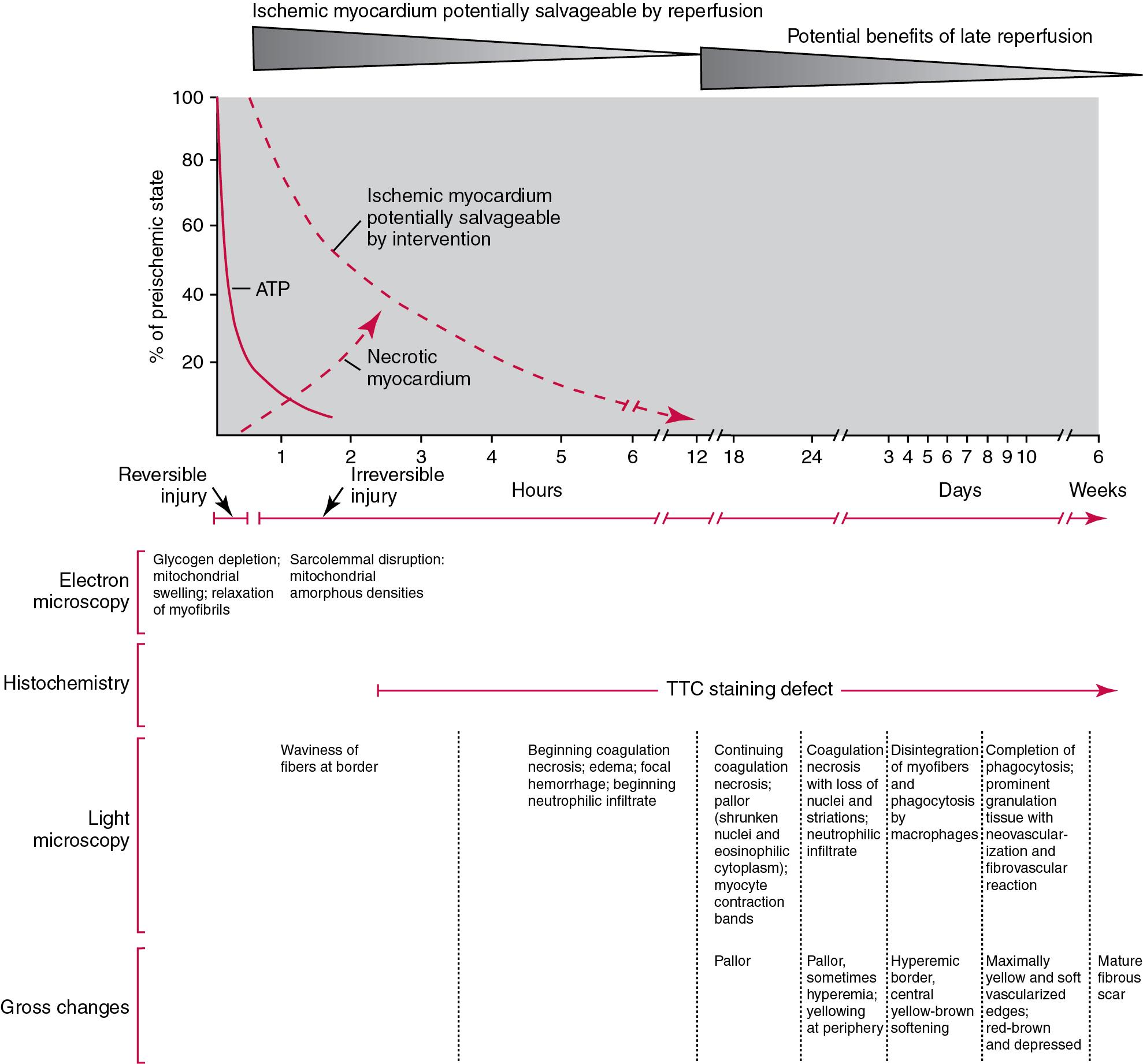 Cardiac function - Clinical Tree