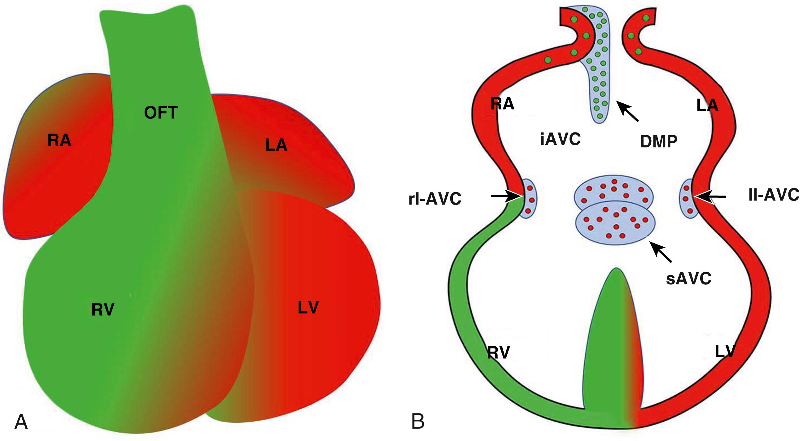 Cardiovascular Development - Clinical Tree