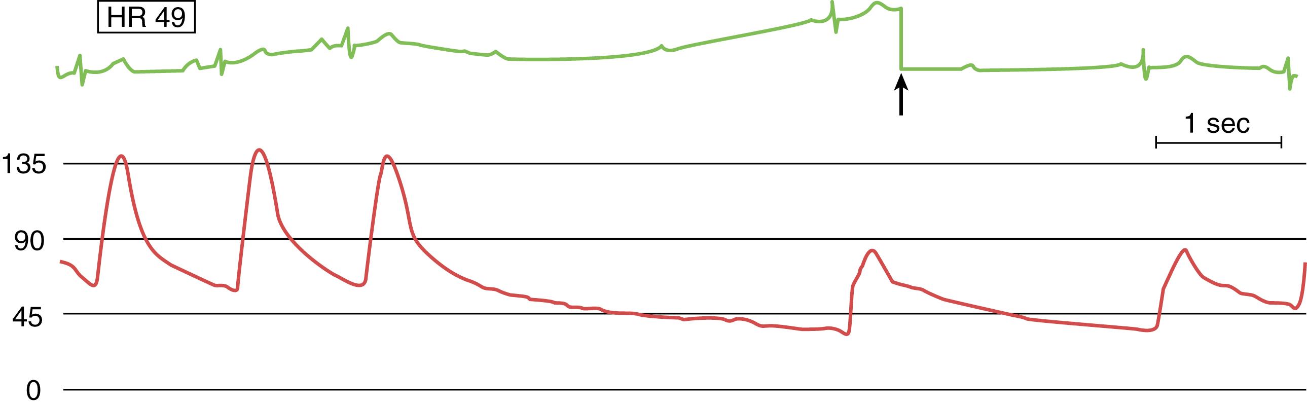 Cardiovascular Monitoring - Clinical Tree