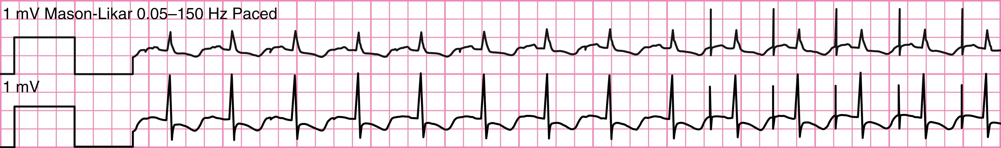 Cardiovascular Monitoring - Clinical Tree