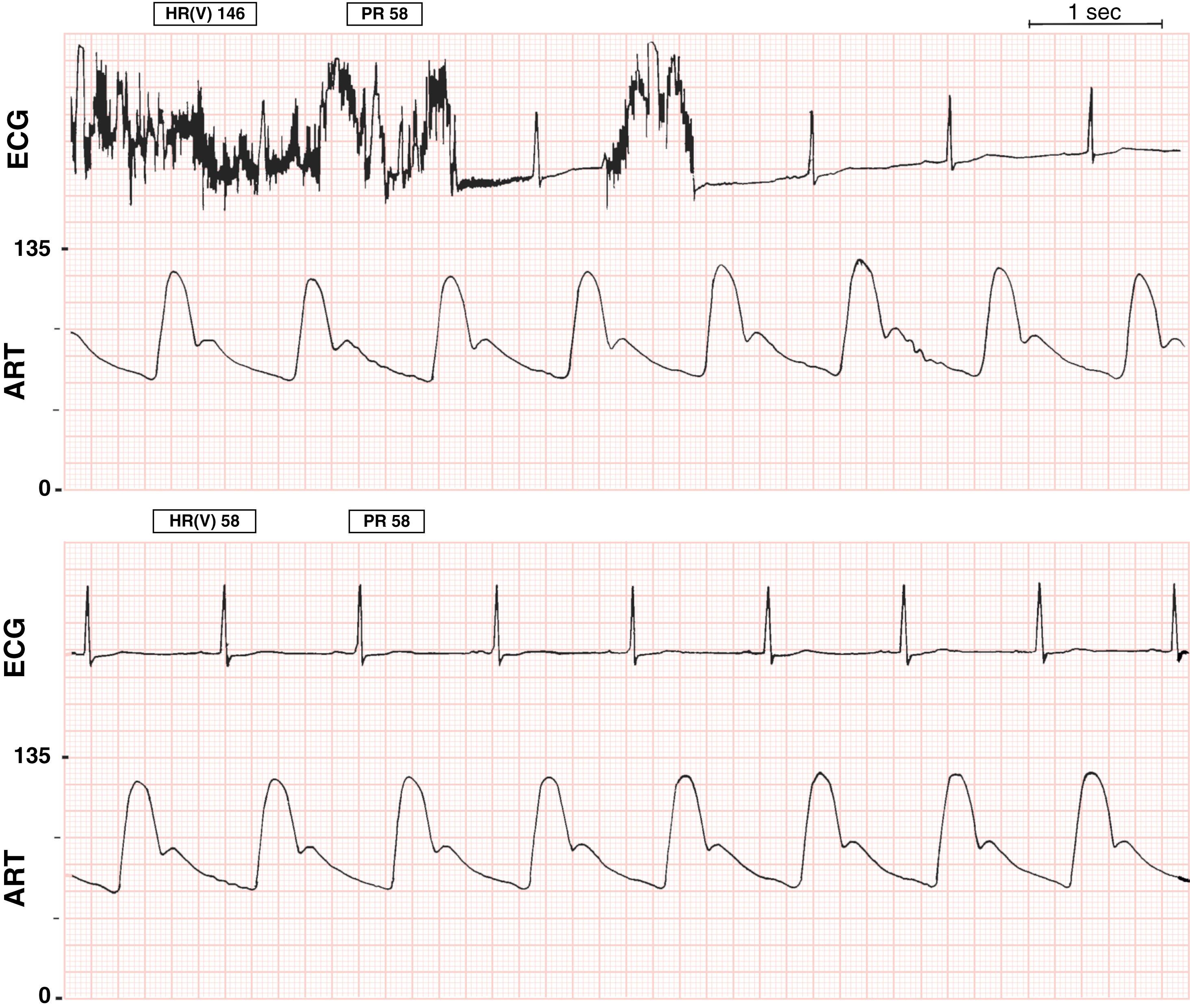 Cardiovascular Monitoring - Clinical Tree