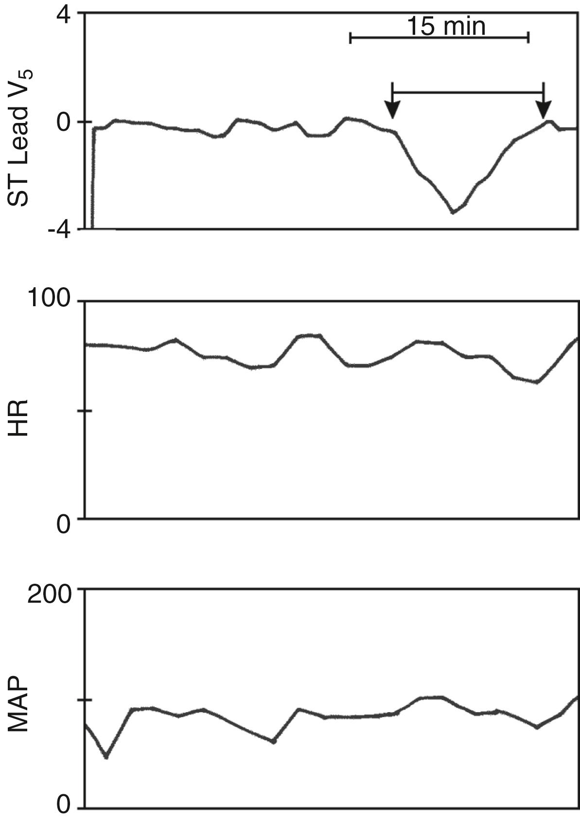 Cardiovascular Monitoring - Clinical Tree