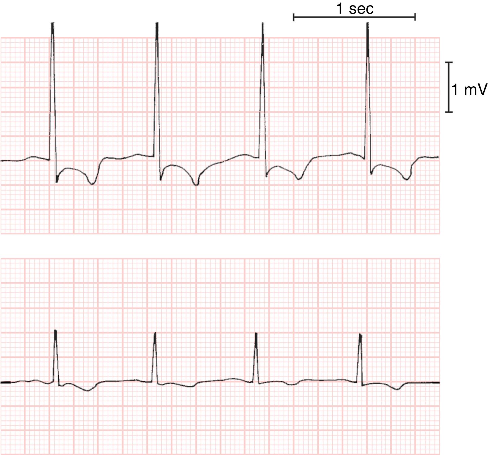 Cardiovascular Monitoring - Clinical Tree