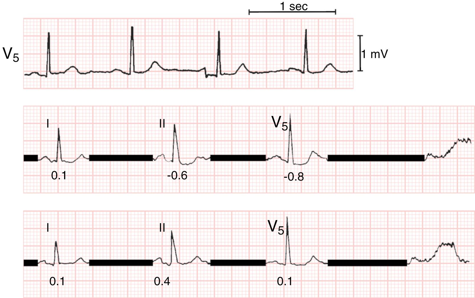 Cardiovascular Monitoring - Clinical Tree