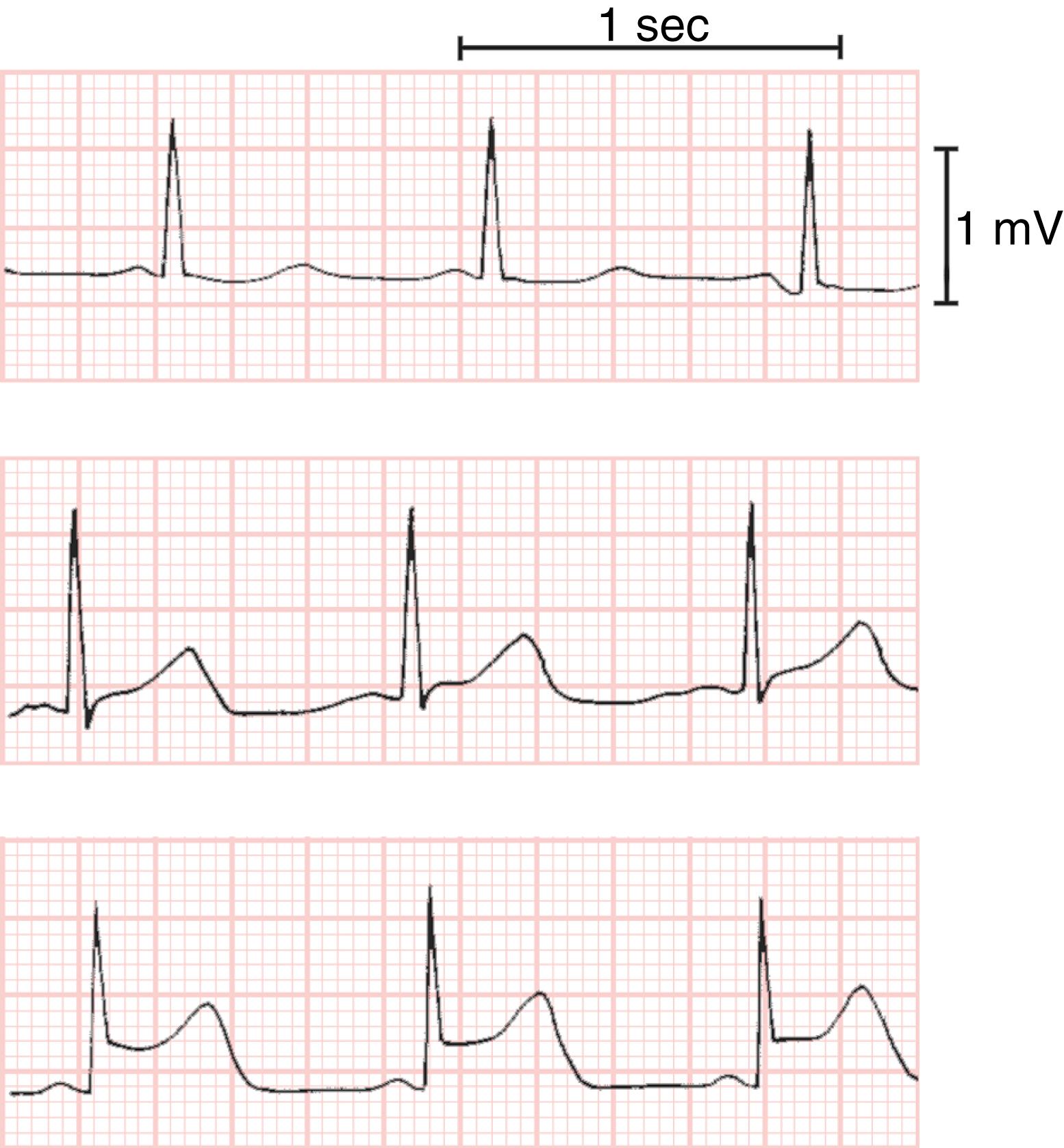 Cardiovascular Monitoring - Clinical Tree
