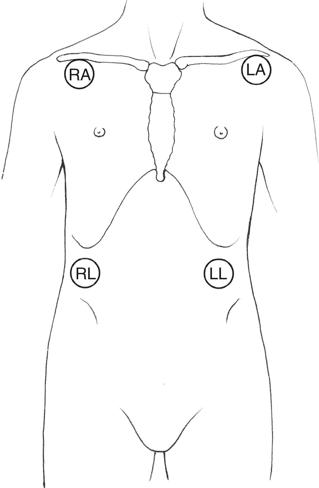 Cardiovascular Monitoring - Clinical Tree