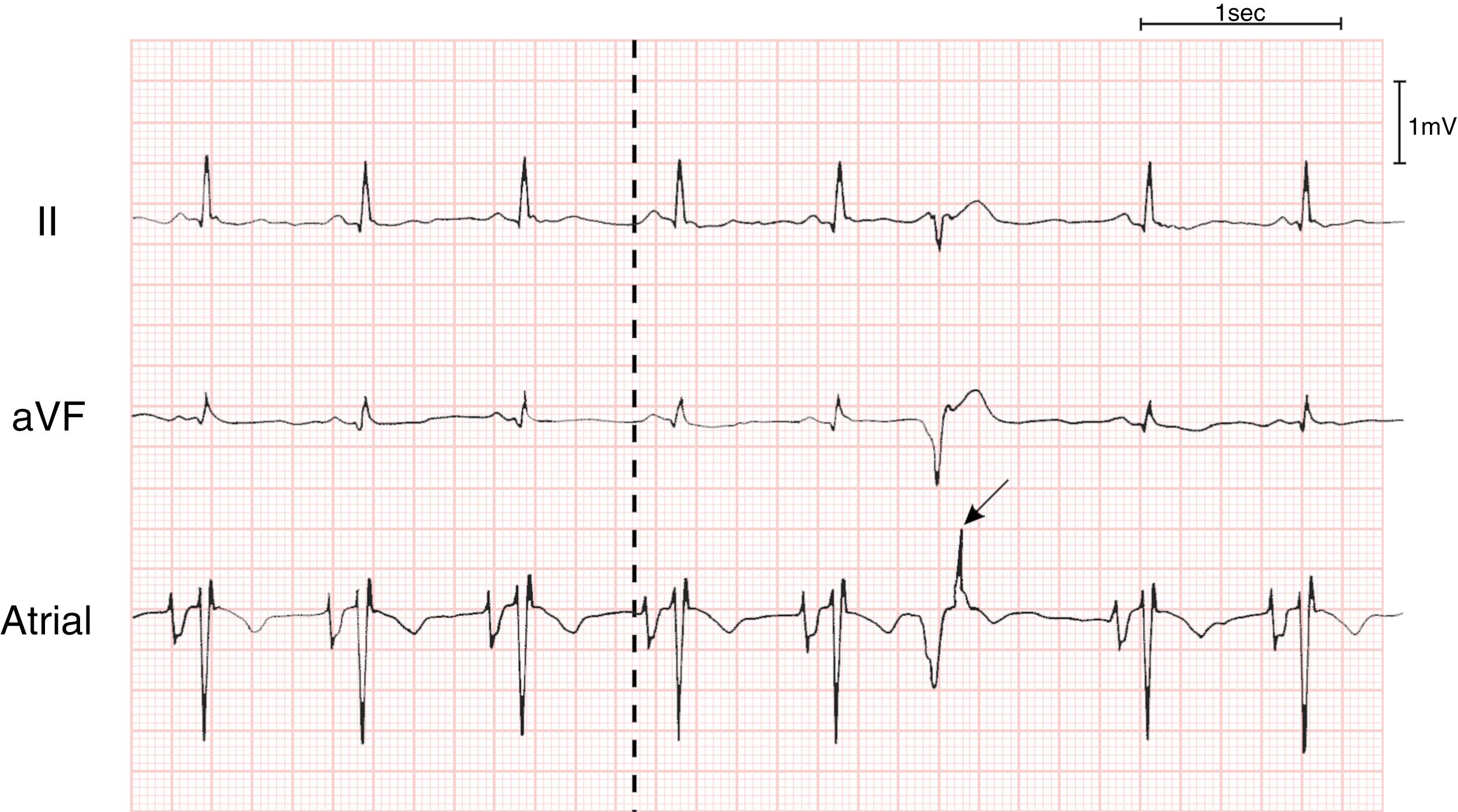 Cardiovascular Monitoring - Clinical Tree