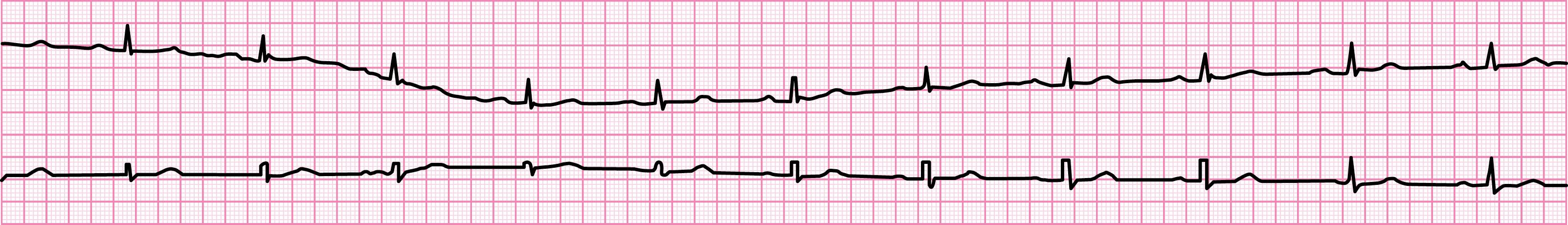 Cardiovascular Monitoring - Clinical Tree