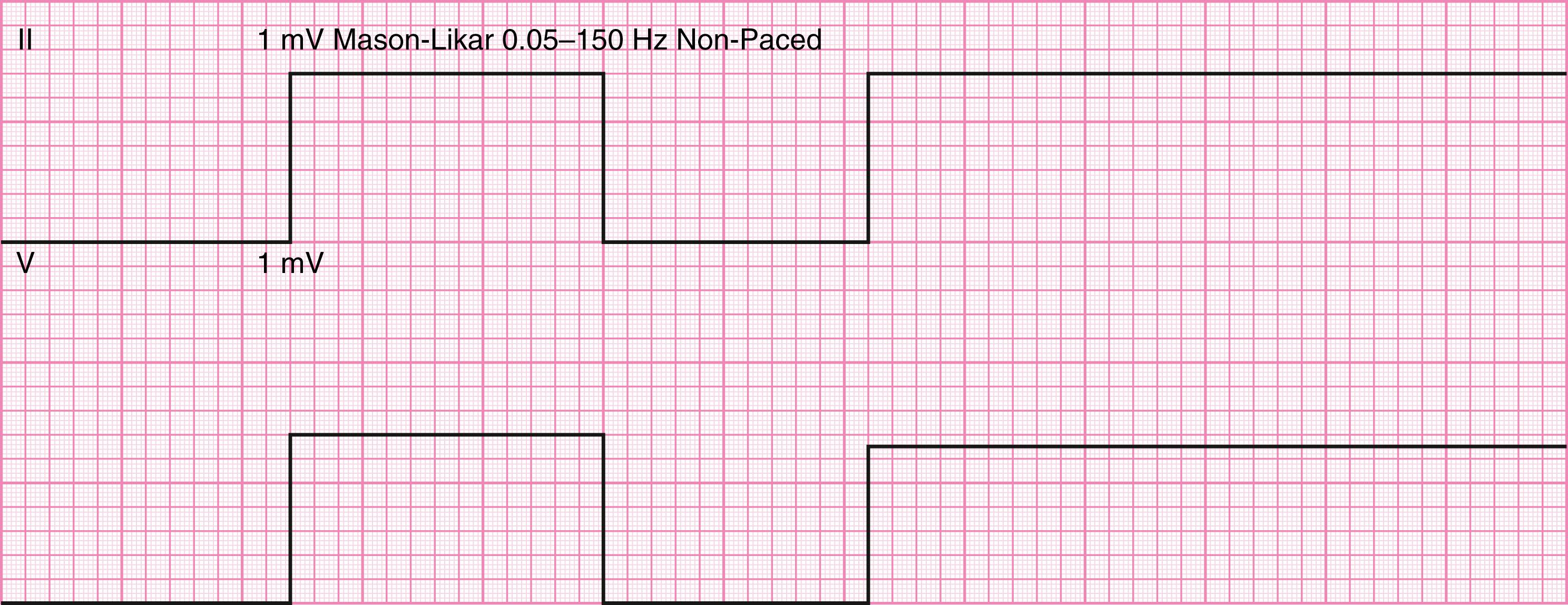 Cardiovascular Monitoring - Clinical Tree