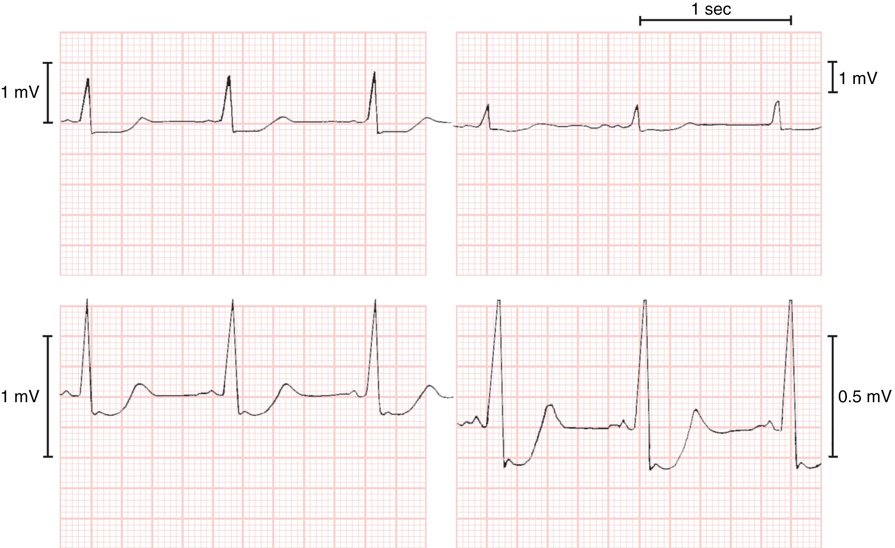 Cardiovascular Monitoring - Clinical Tree