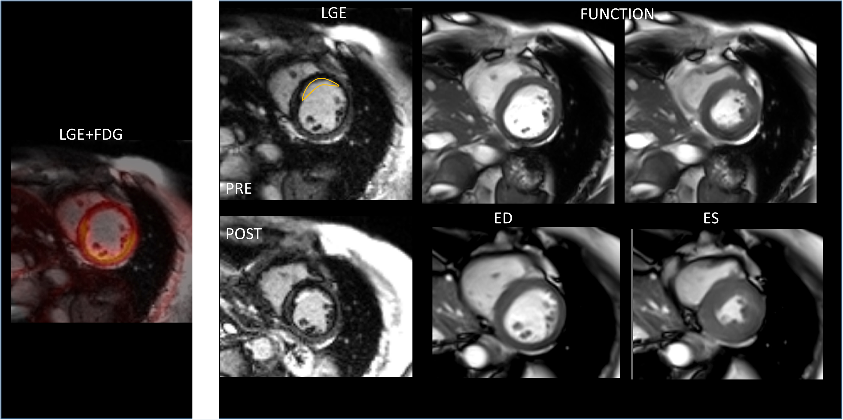 Cardiovascular imaging - Clinical Tree