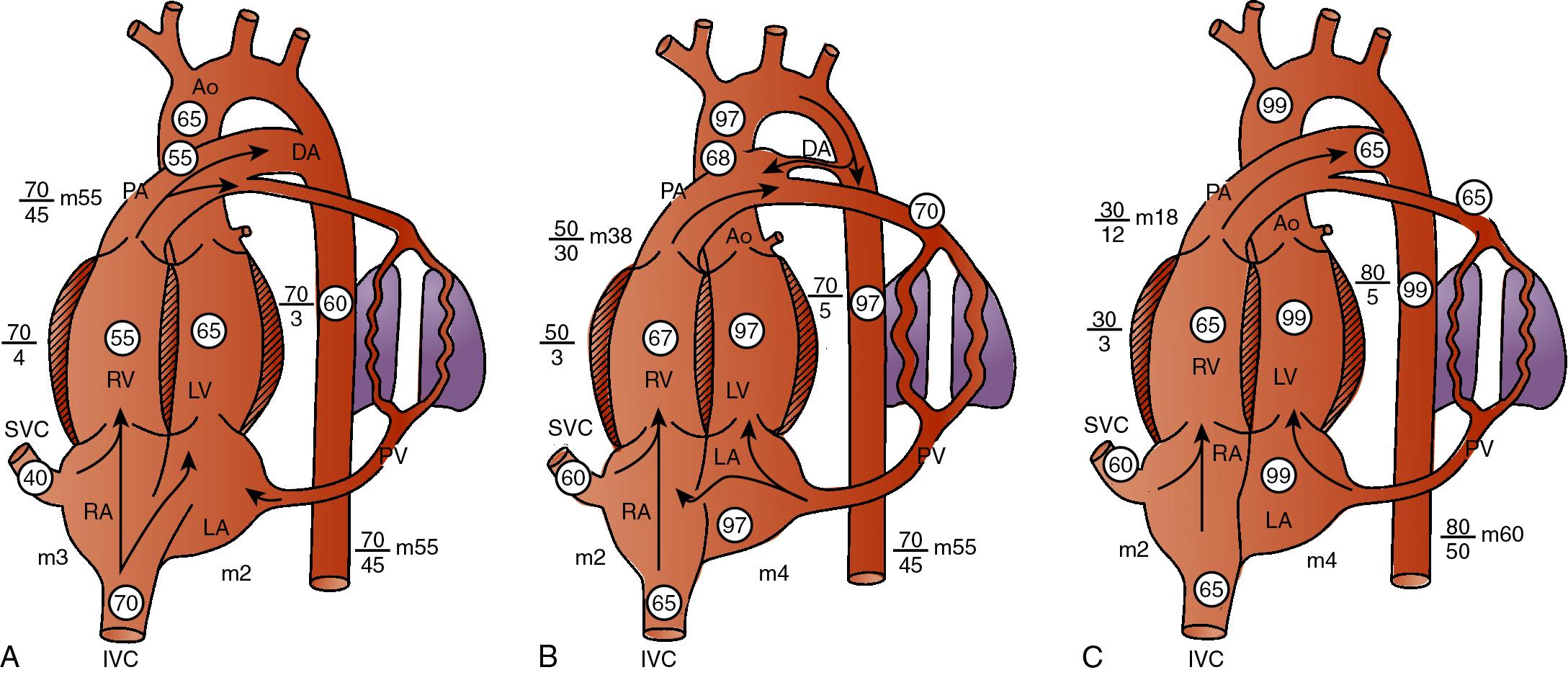 Cardiovascular physiology - Clinical Tree