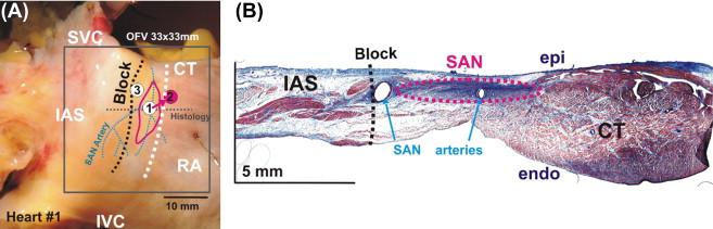 Cellular and Molecular Pathobiology of the Cardiac Conduction System ...