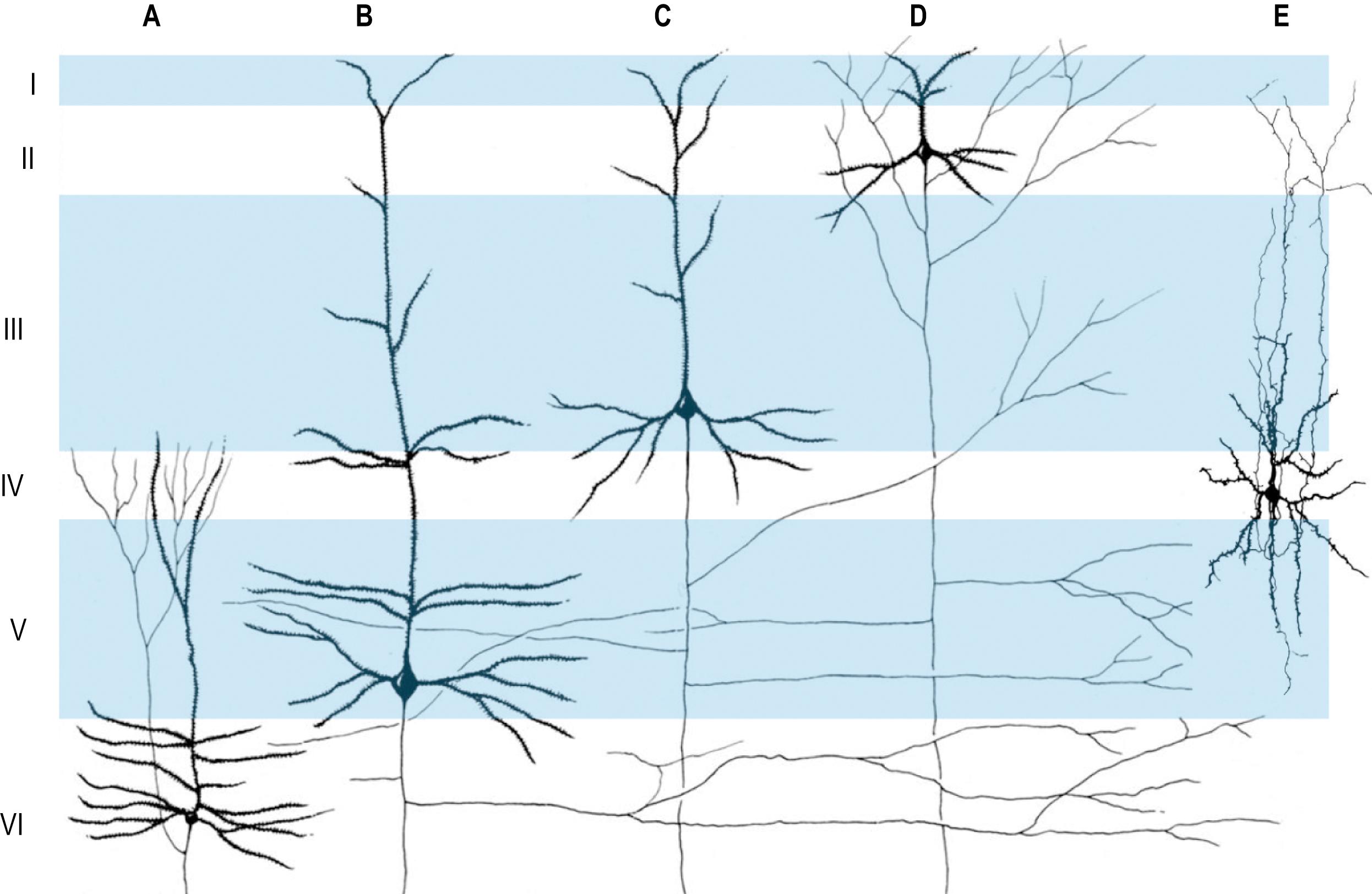 Cerebral hemispheres - Clinical Tree