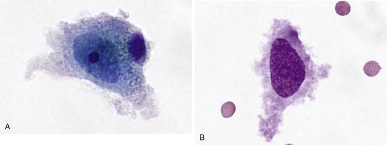 Cerebrospinal Fluid - Clinical Tree