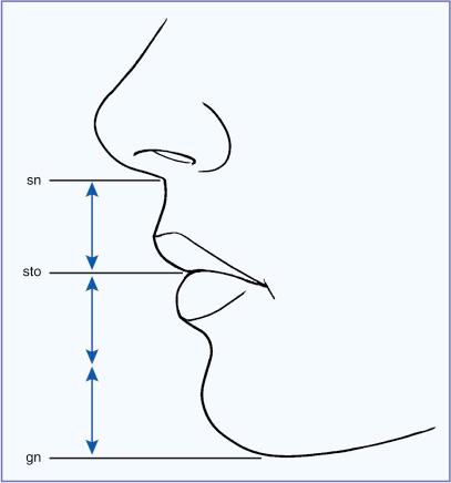 Chin - Clinical Tree