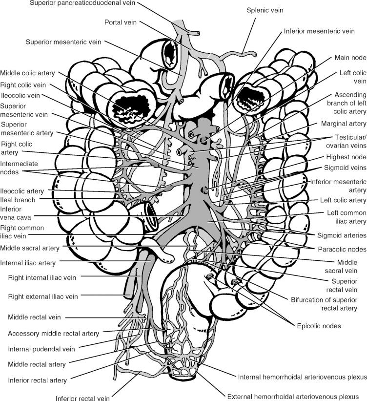 Colectomy, Partial – Open - Clinical Tree