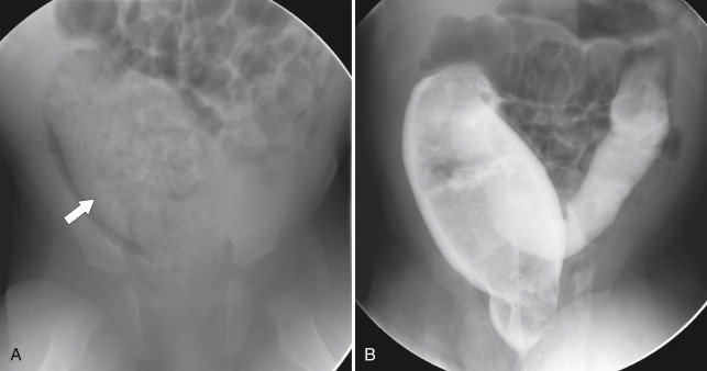 Colon and Appendix - Clinical Tree