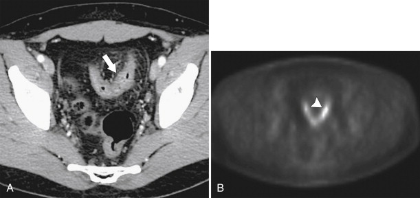 Colon and Appendix - Clinical Tree