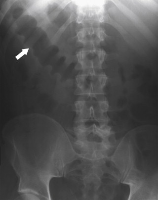 Colon and Appendix - Clinical Tree