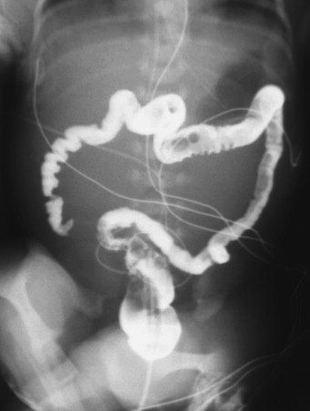 Colon and Appendix - Clinical Tree