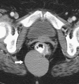 Colon and Appendix - Clinical Tree