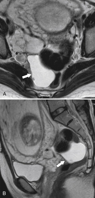 Colon and Appendix - Clinical Tree
