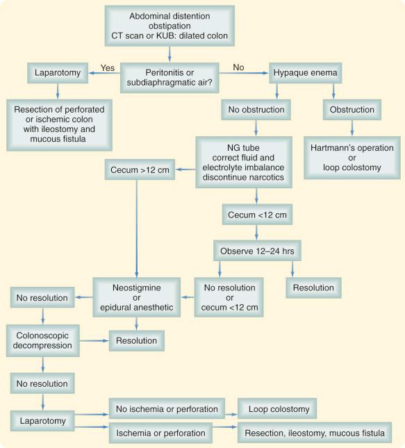 Colostomy Closure - Clinical Tree