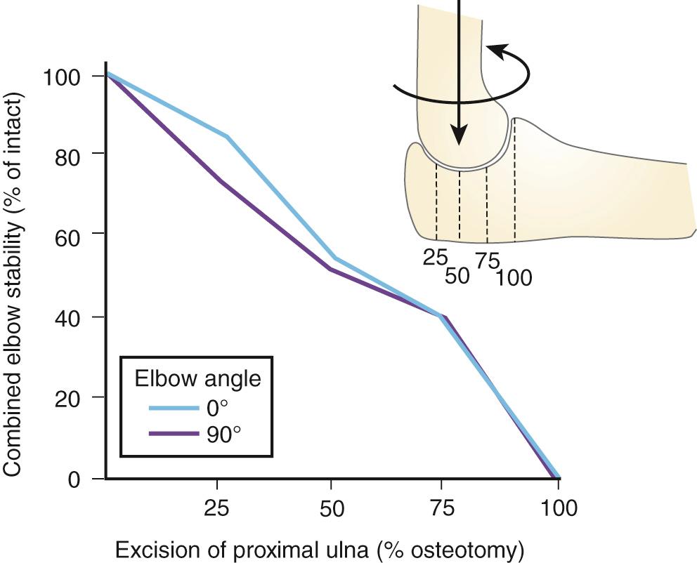 Complex Elbow Instability: General Principles - Clinical Tree