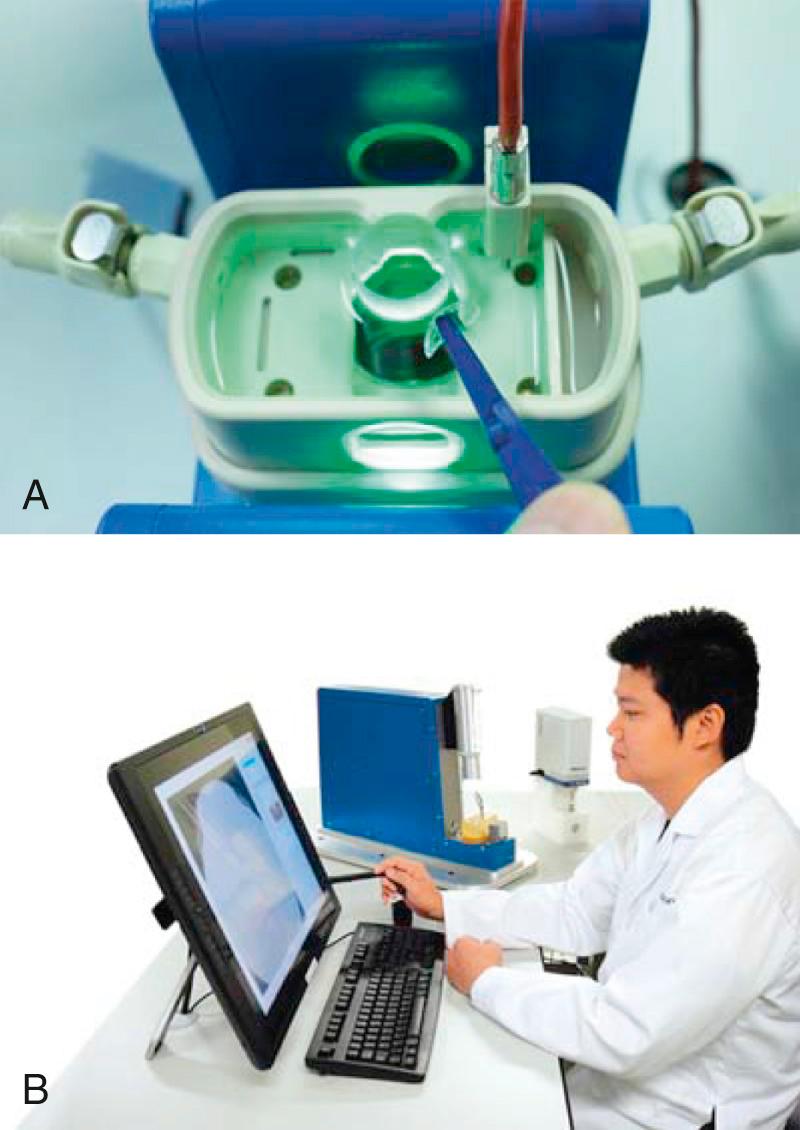 Contact Lens Manufacturing - Clinical Tree