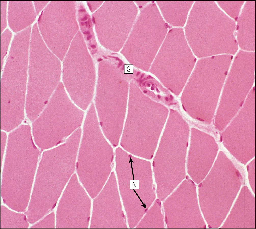 Contractile cells - Clinical Tree