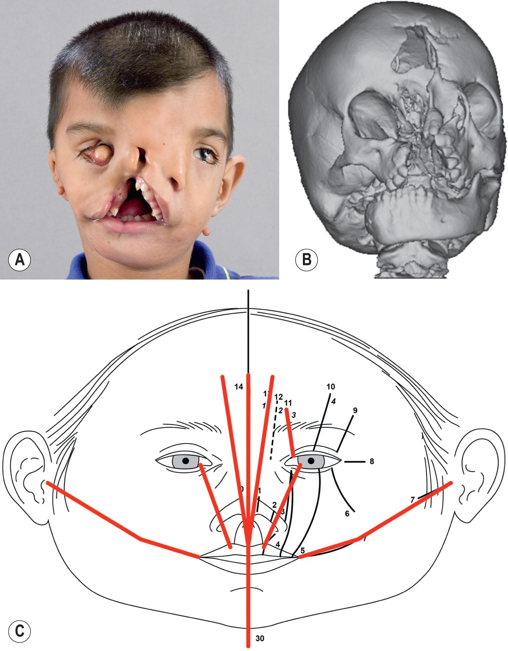 Craniofacial abnormalities - Clinical Tree