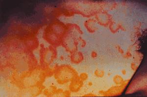 Dermatologic Presentations - Clinical Tree