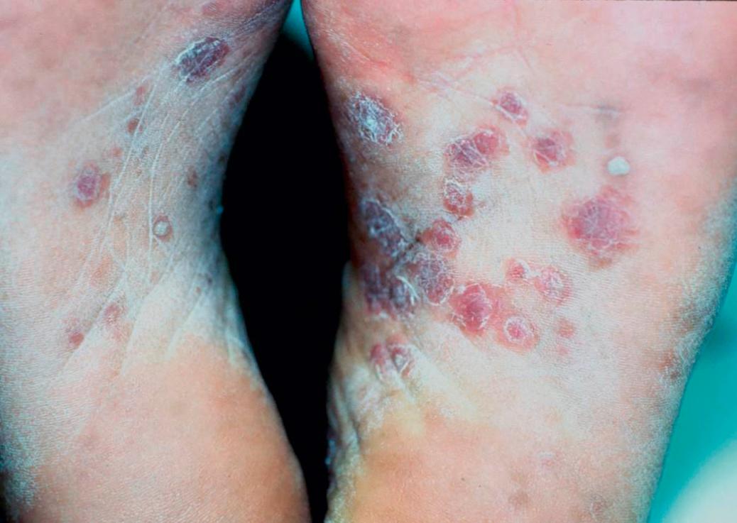 Dermatologic Presentations - Clinical Tree