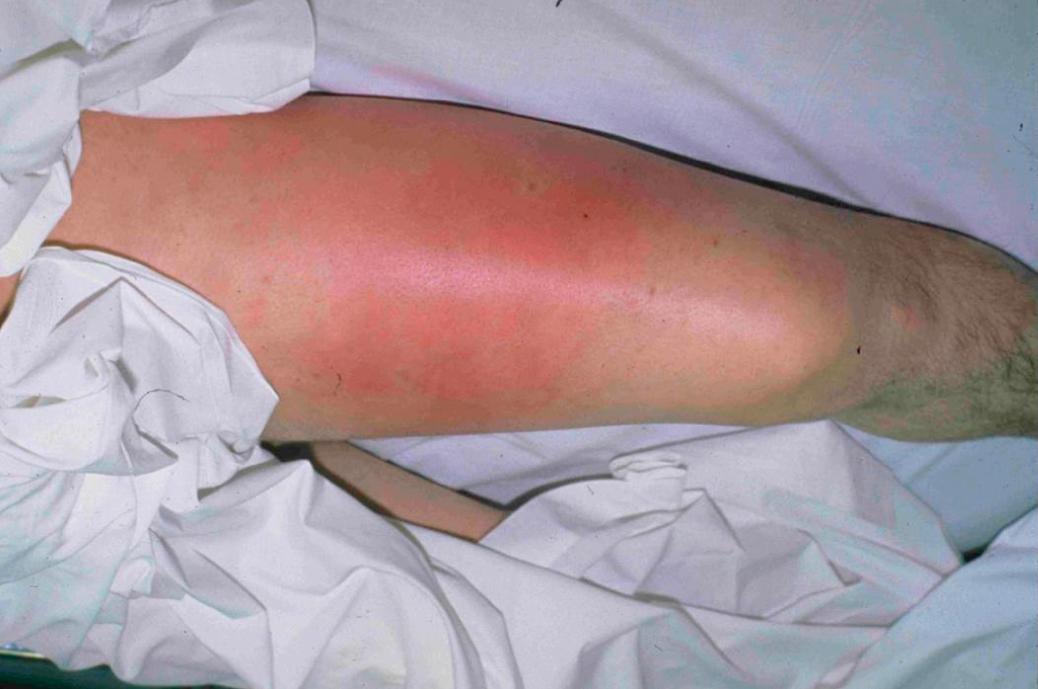 Dermatologic Presentations - Clinical Tree