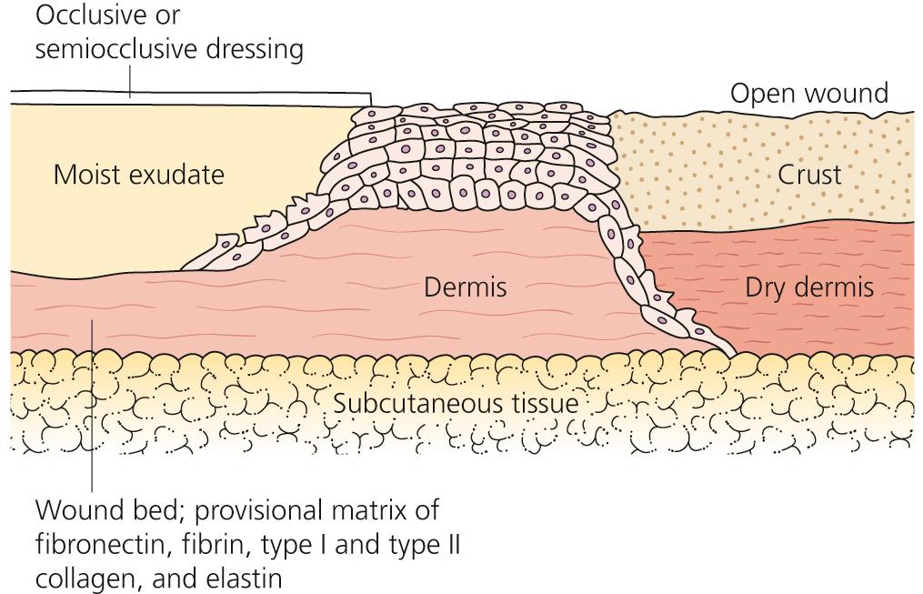 Dermatologic Surgical Procedures - Clinical Tree