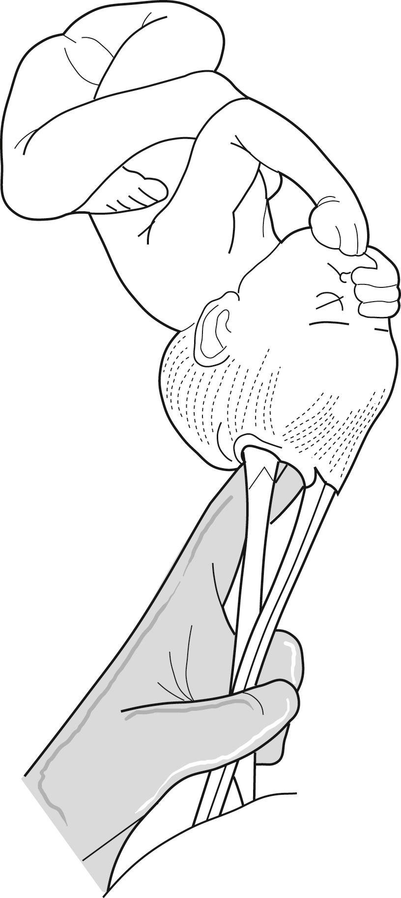 Destructive Operations on the Fetus - Clinical Tree