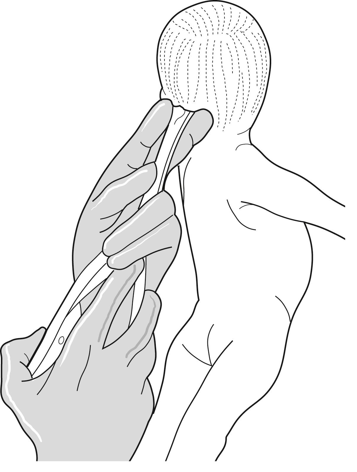 Destructive Operations on the Fetus - Clinical Tree