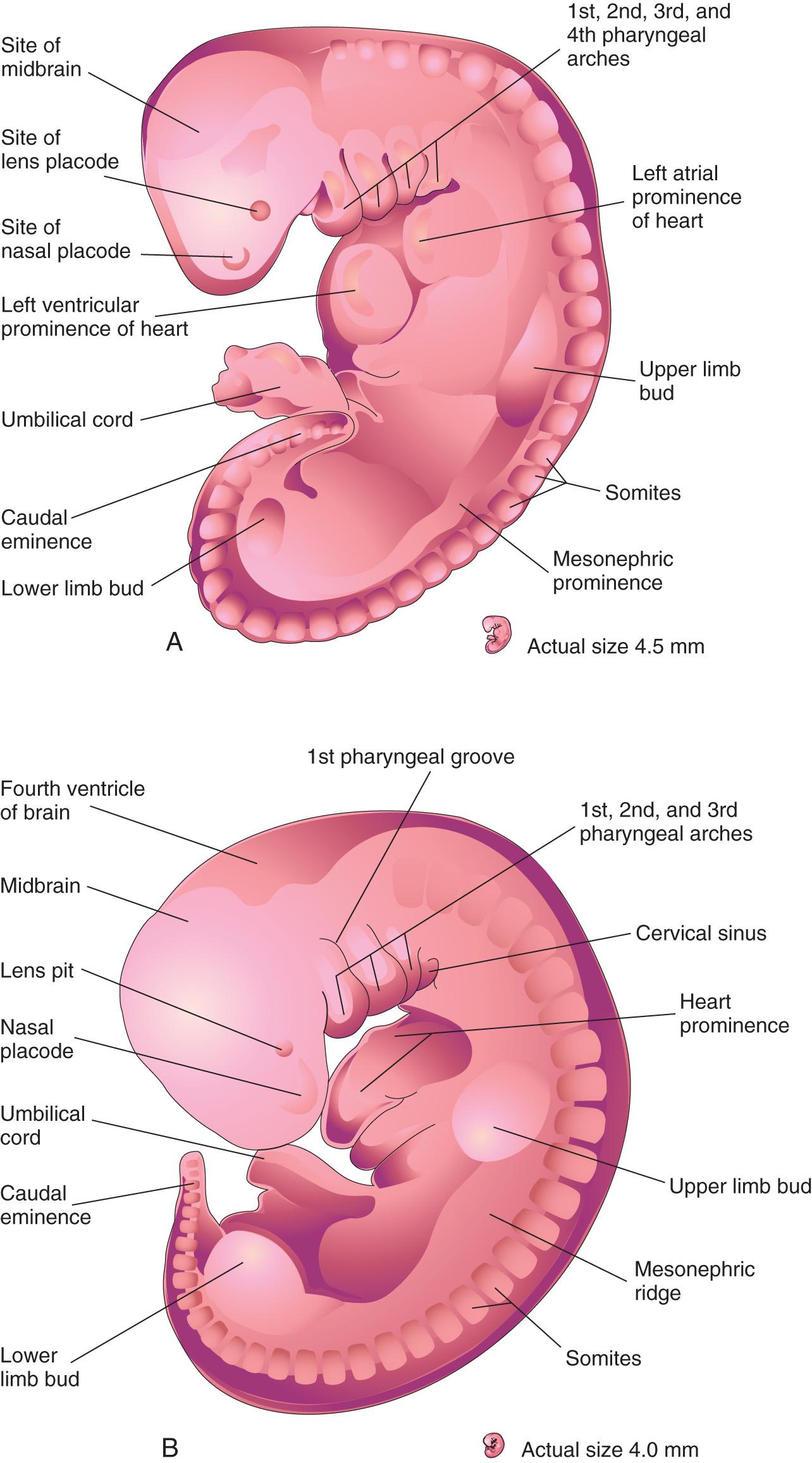 Development of Limbs - Clinical Tree