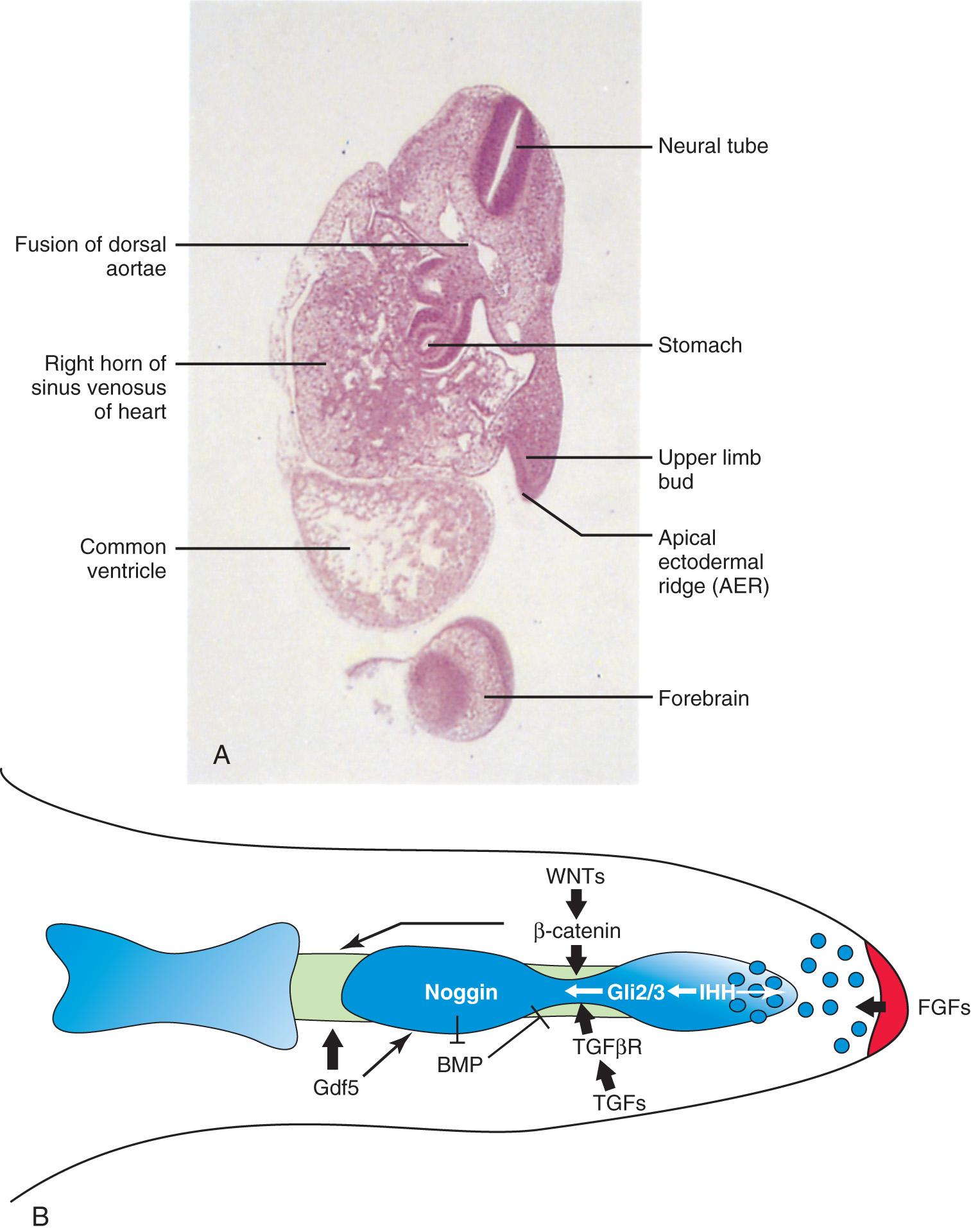 Development of Limbs - Clinical Tree