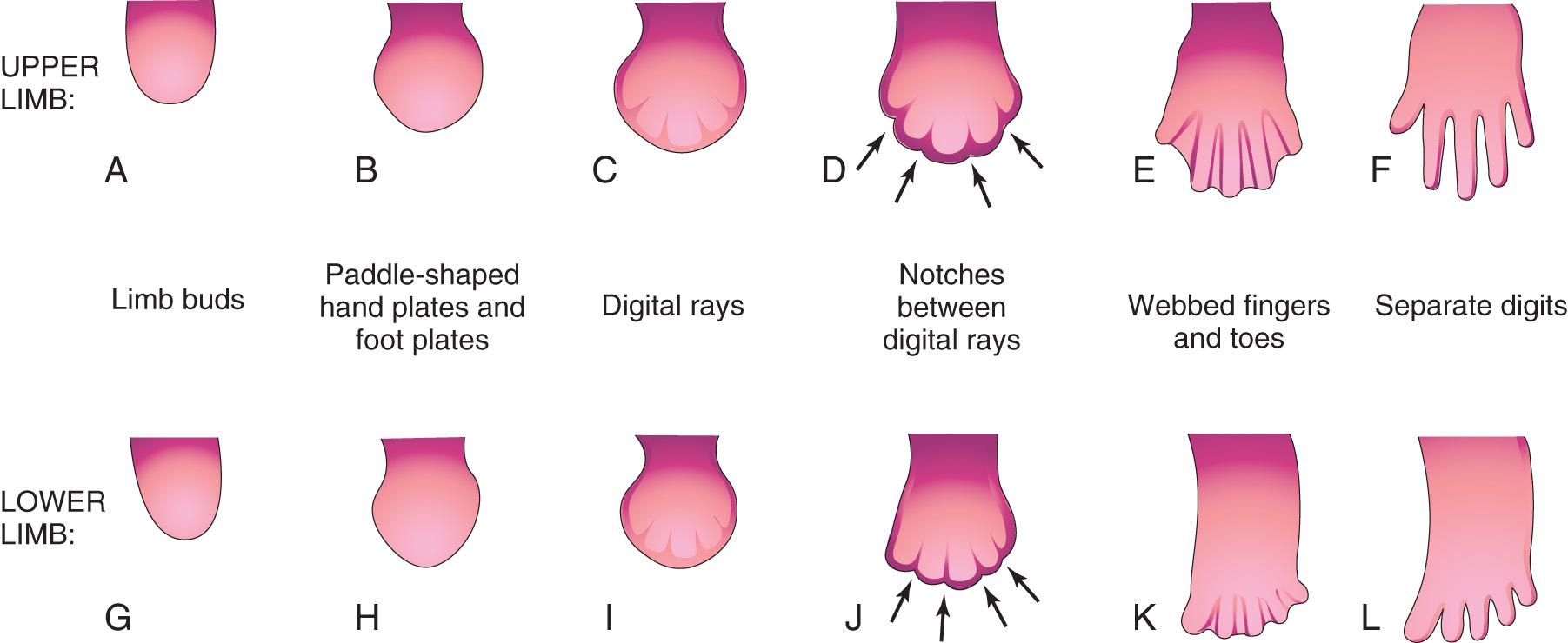Development of Limbs - Clinical Tree