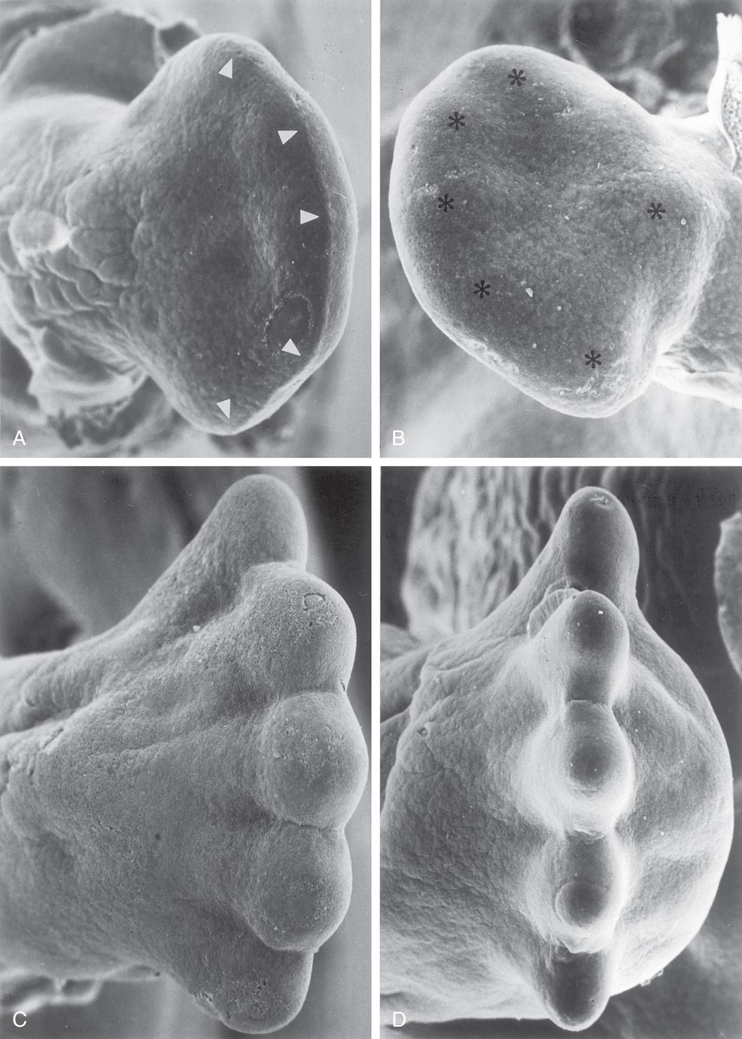 Development of Limbs - Clinical Tree