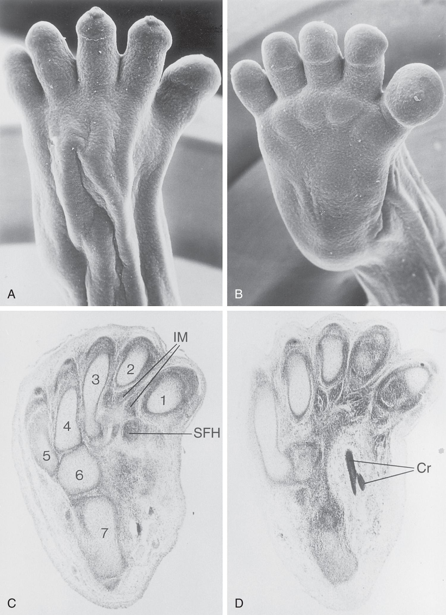 Development of Limbs - Clinical Tree