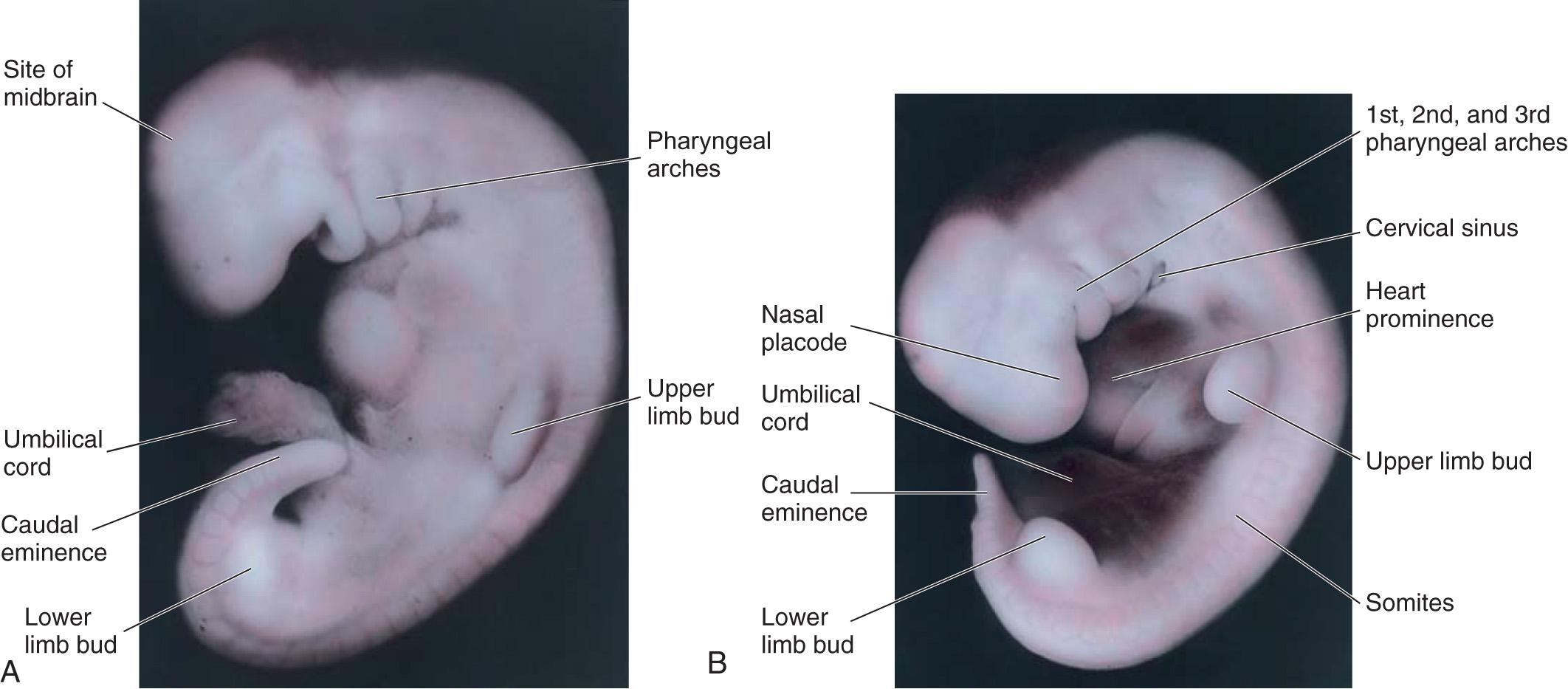 Development of Limbs - Clinical Tree