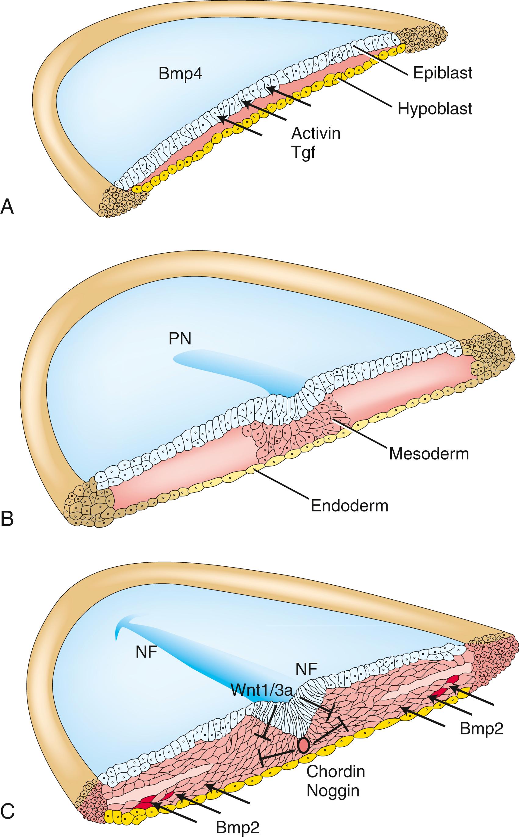 Development of the Heart - Clinical Tree